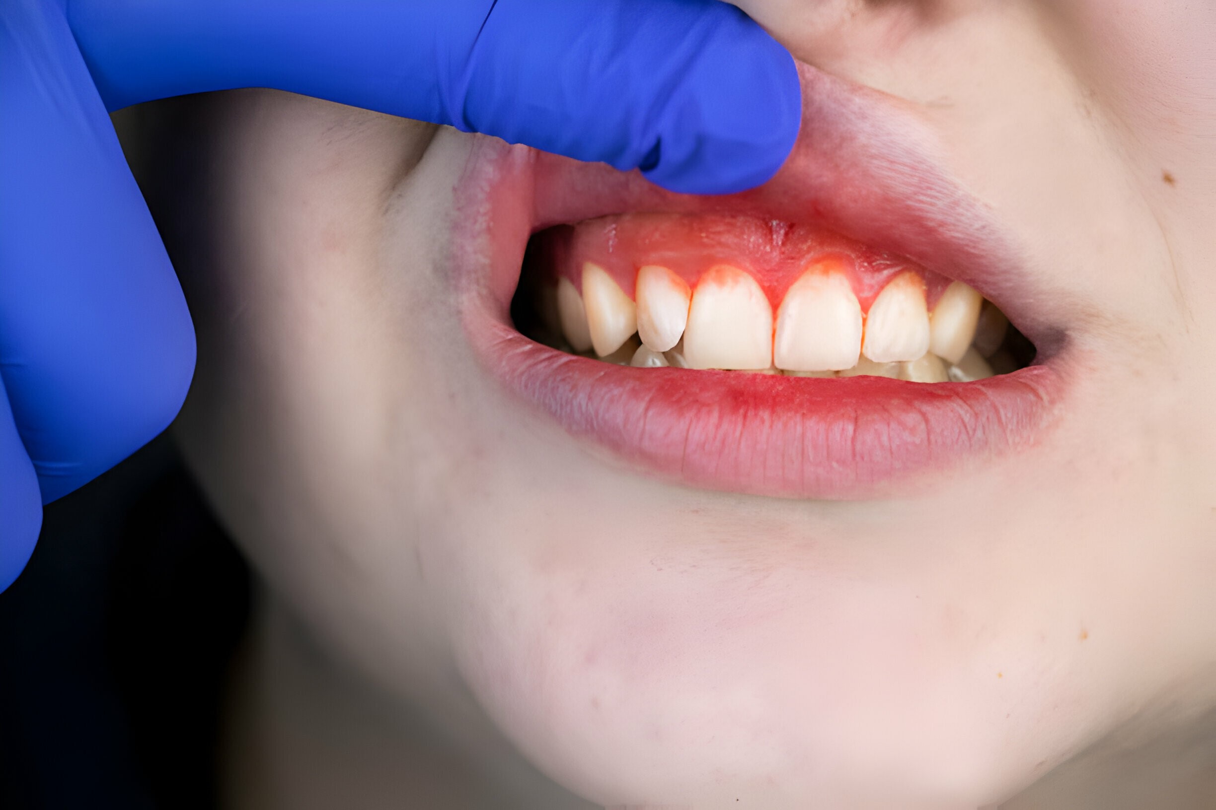 Conheça as principais doenças bucais e como preveni-las - Dall'Oca ...